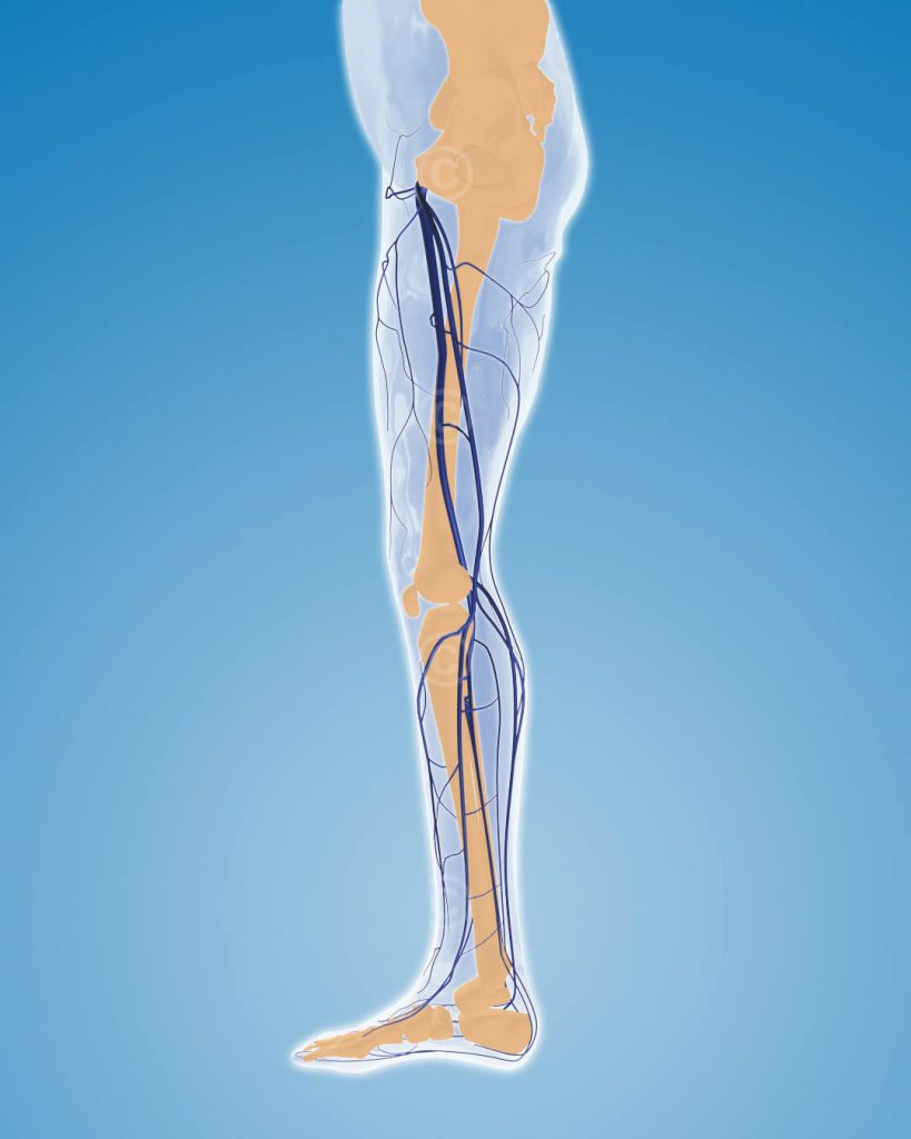 3D Modell Beinvenen - MedicalGraphics