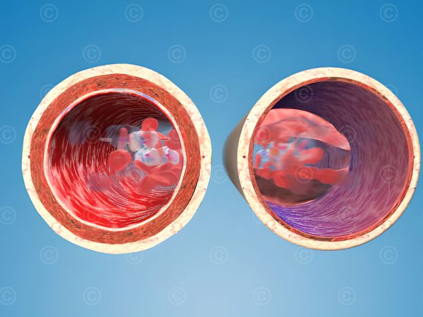 Animation comparison of veins and arteries - MedicalGraphics