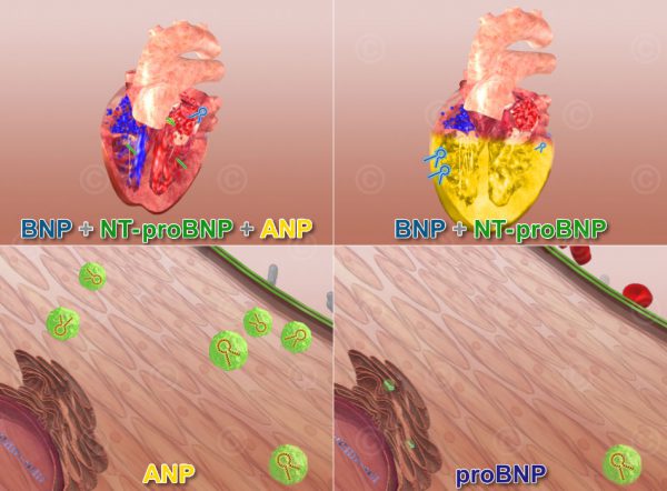 3D animation BNP for diagnosis - MedicalGraphics