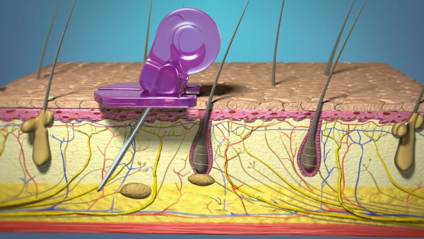 Medical product video "3d animation blood glucose meter" - MedicalGraphics