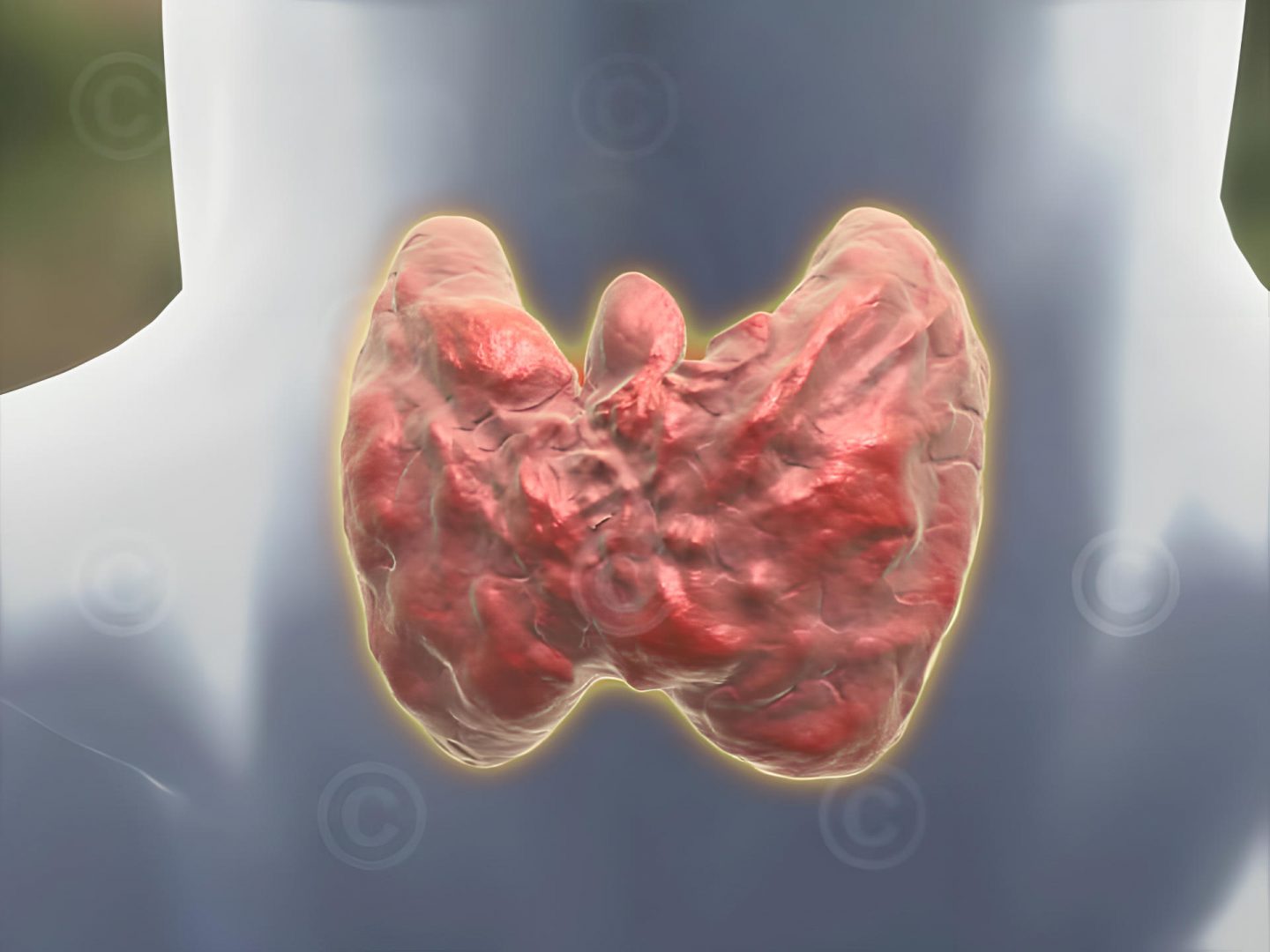 Medical video thyroid disease - MedicalGraphics