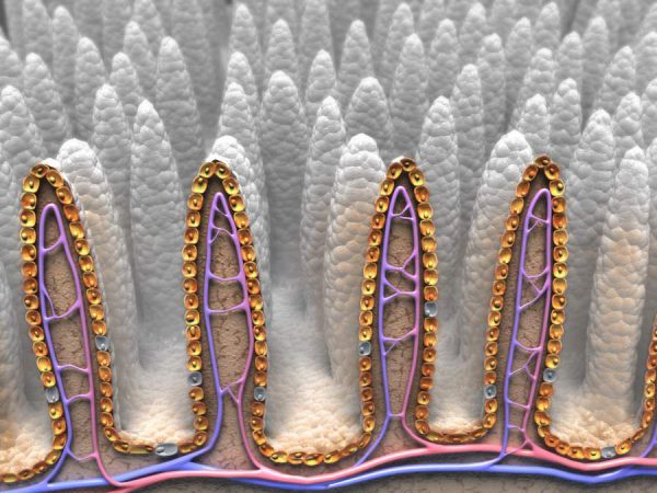 Illustration Darmzotten - MedicalGraphics