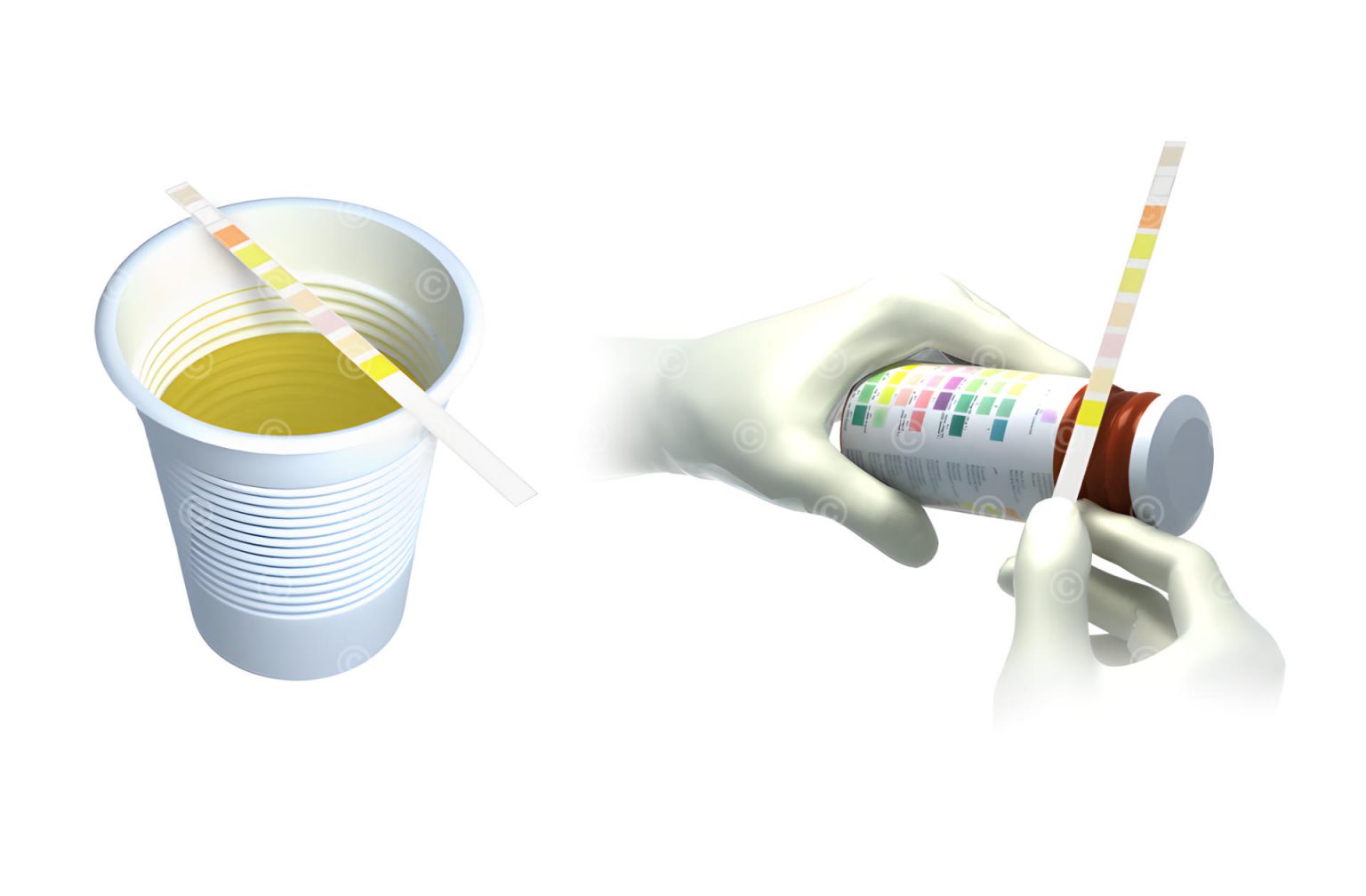 Illustration Urinteststreifen - MedicalGraphics