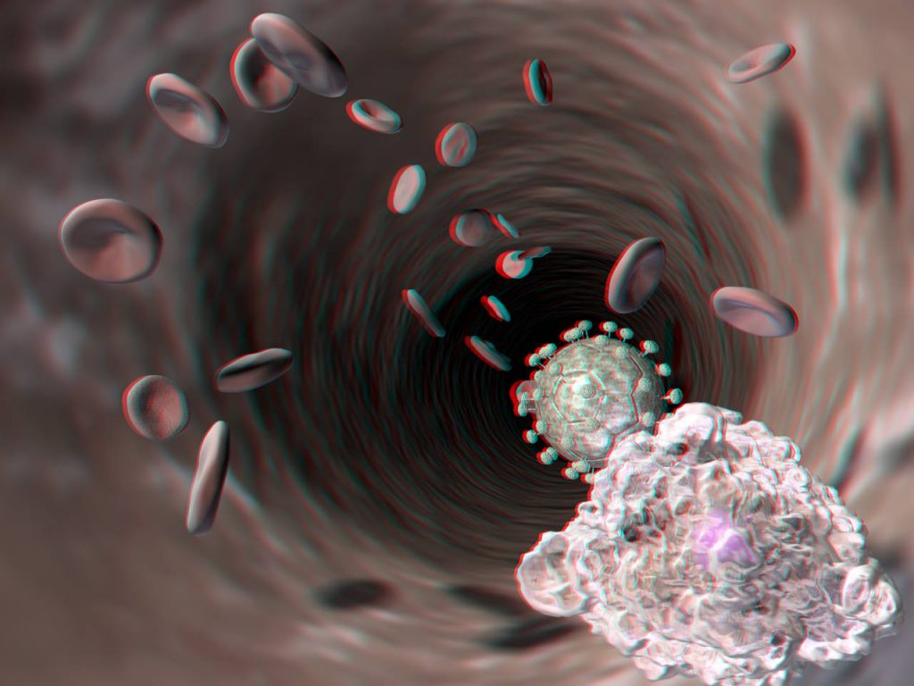 Stereoscopic 3D animations about prostate cancer - MedicalGraphics