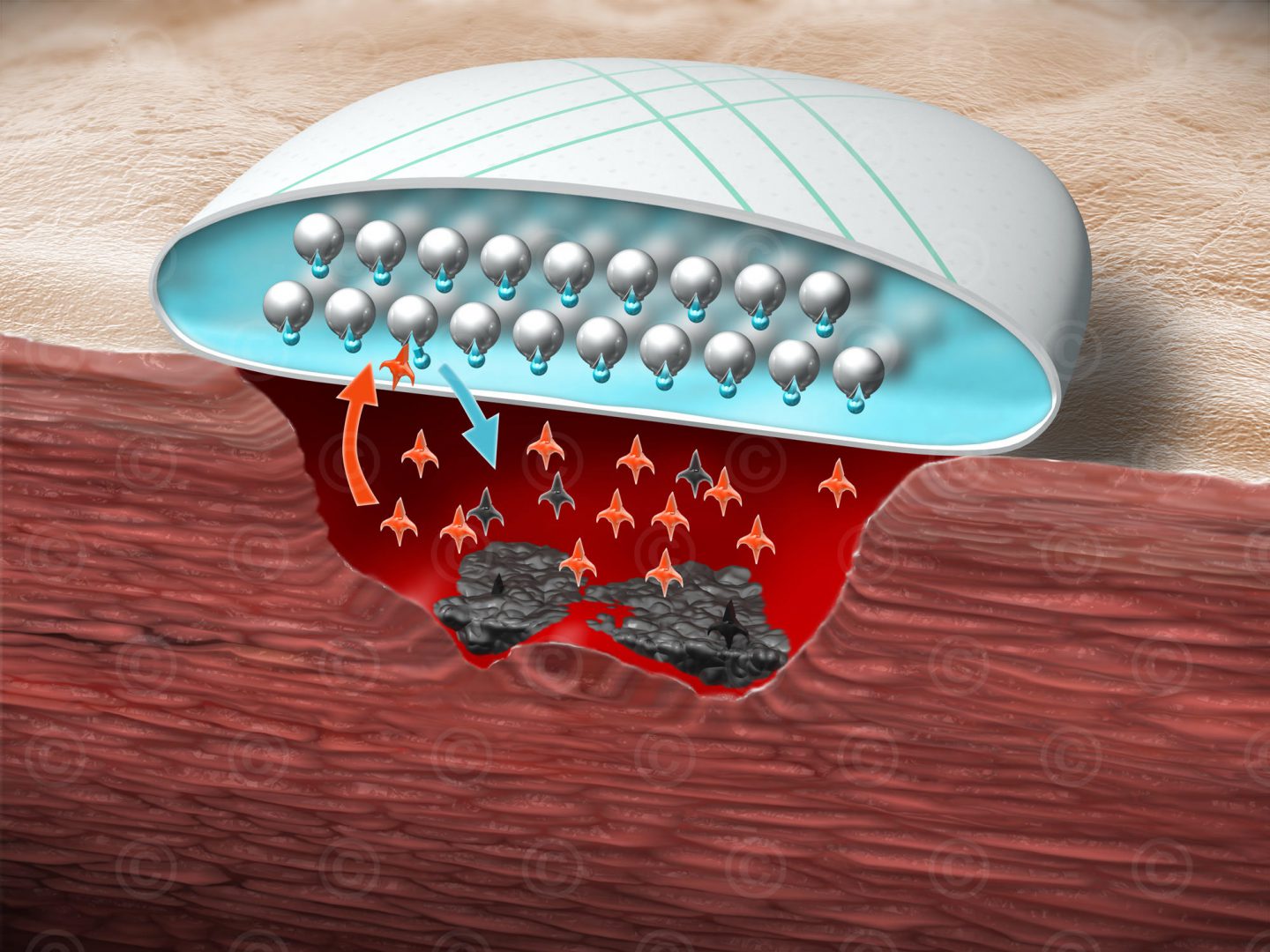 Illustration of chronic wound compared to the acute wound - MedicalGraphics