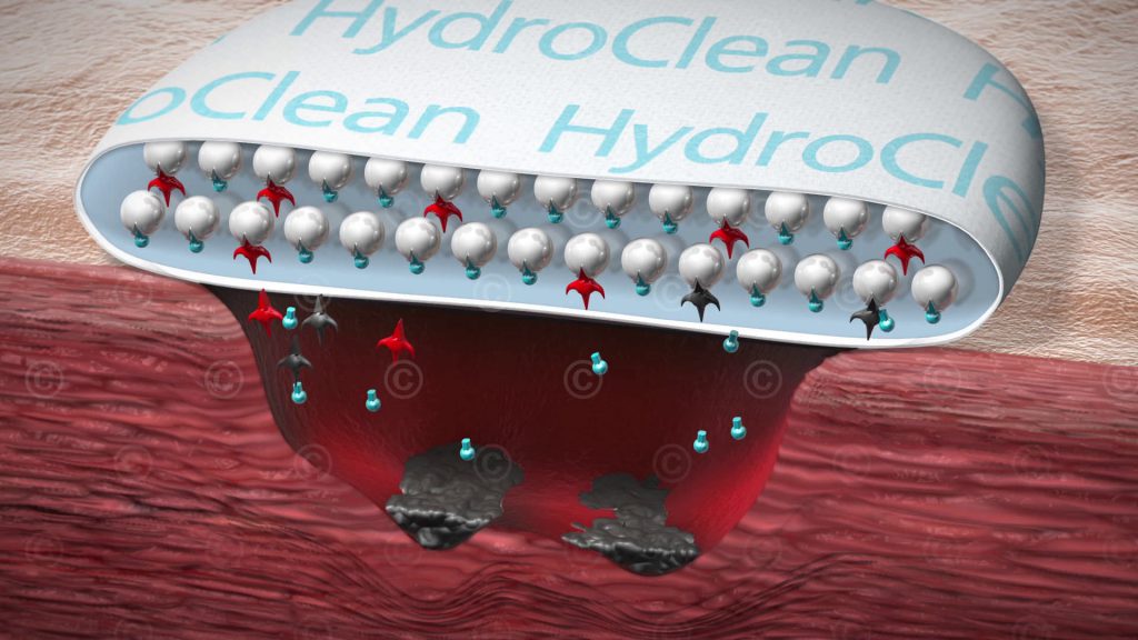 HydroClean wound dressing animation - MedicalGraphics
