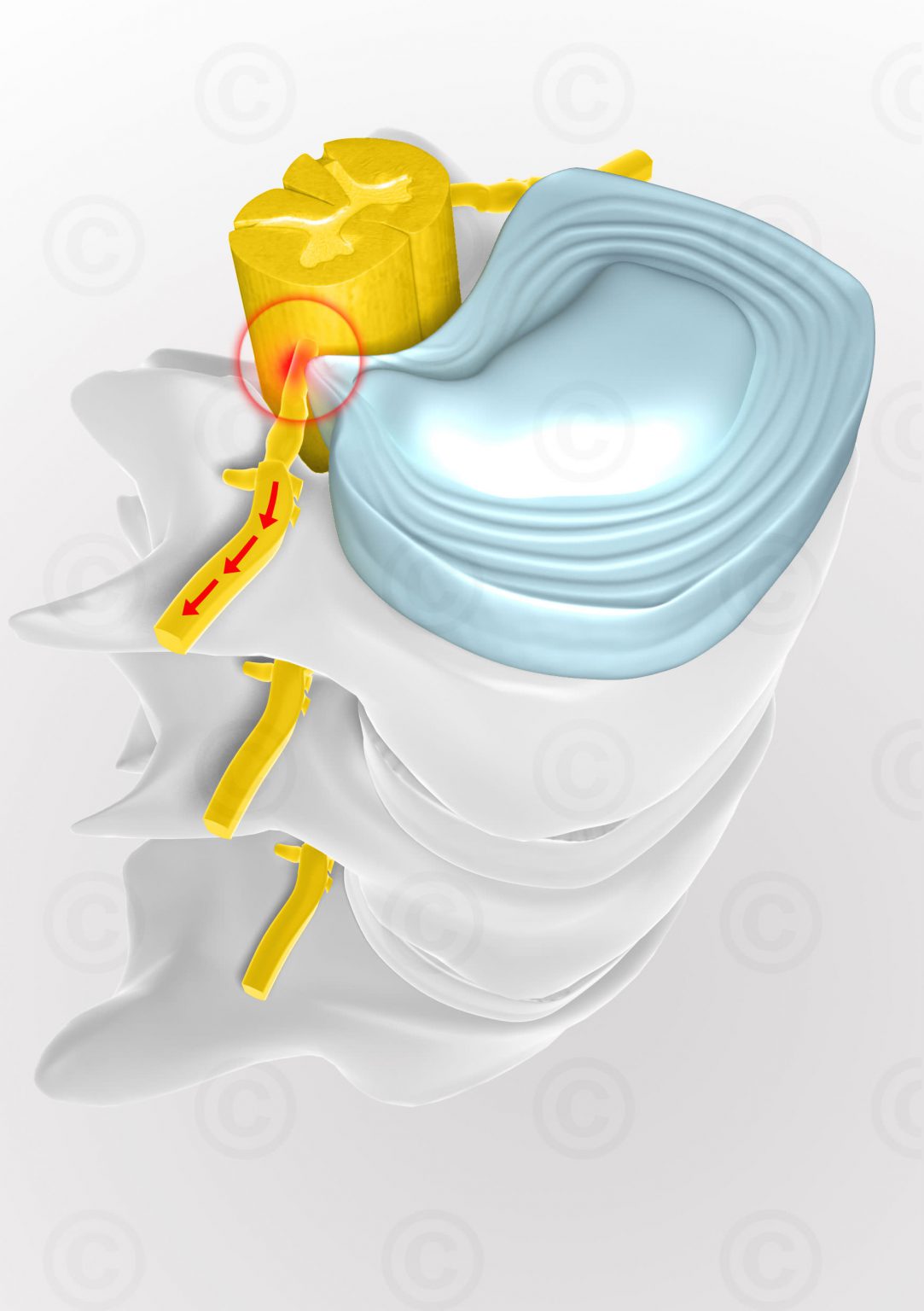 Illustration anatomy tonsils - MedicalGraphics