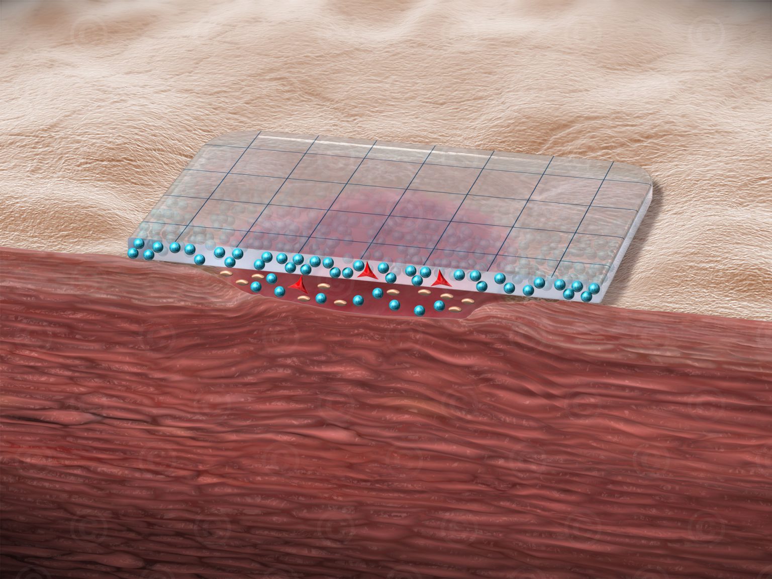 3D animations and illustrations "Wound treatment Paul Hartmann AG ...