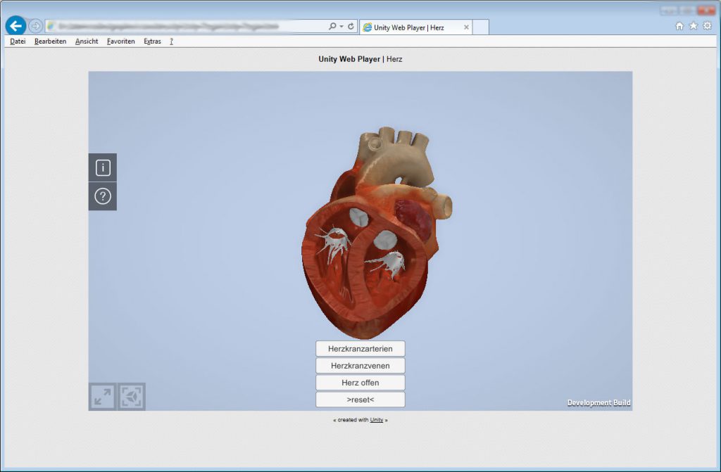 Interactive heart with Unity3D - MedicalGraphics