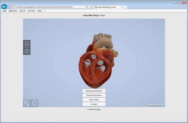 Interactive heart with Unity3D - MedicalGraphics