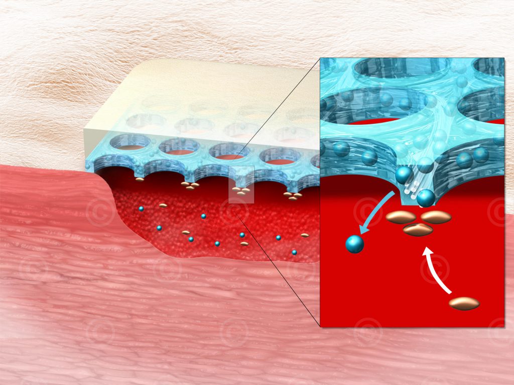 Animation wound dressing HydroTac transparent - MedicalGraphics