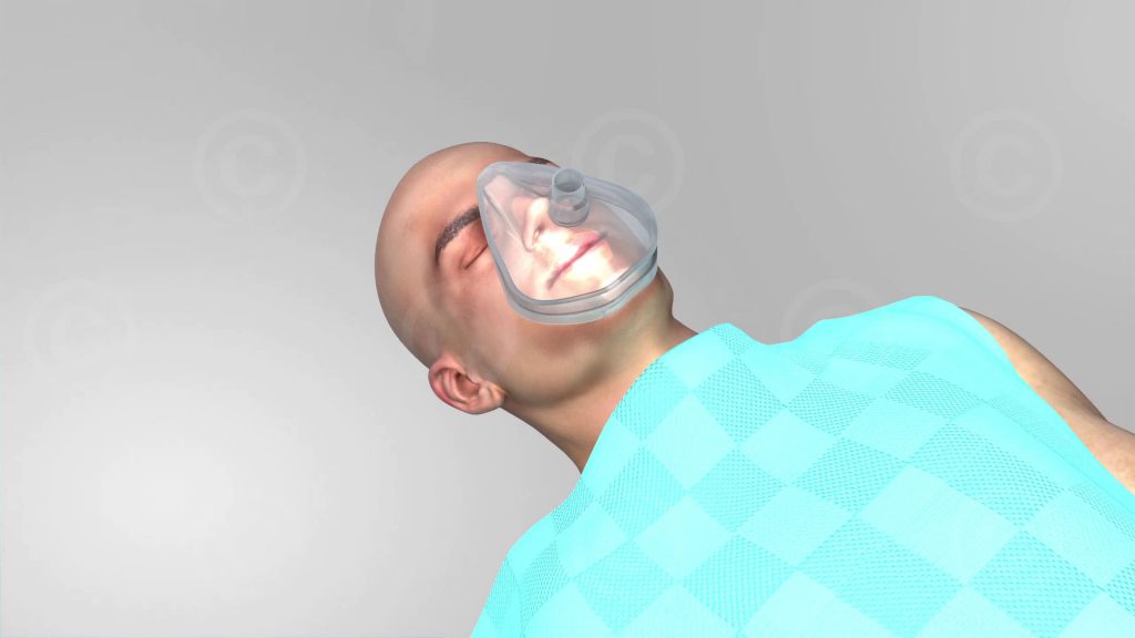 Medical animation anesthesia - MedicalGraphics