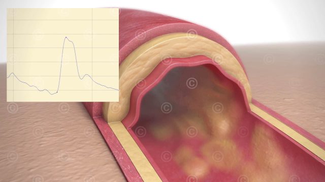 Animation determining biological age - MedicalGraphics