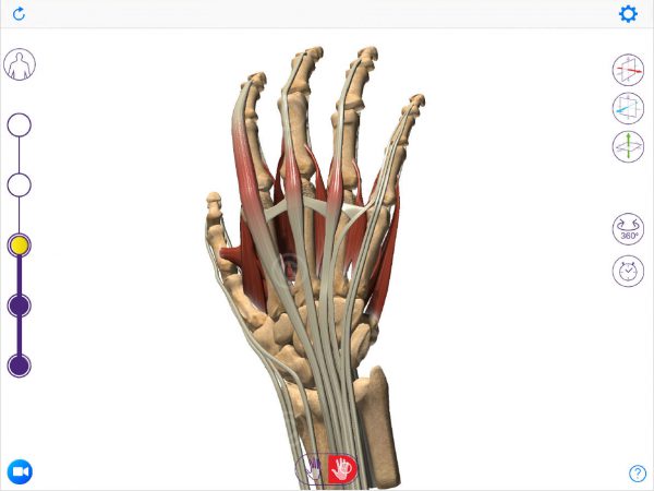 IOS App - Enthesitis Hand - MedicalGraphics