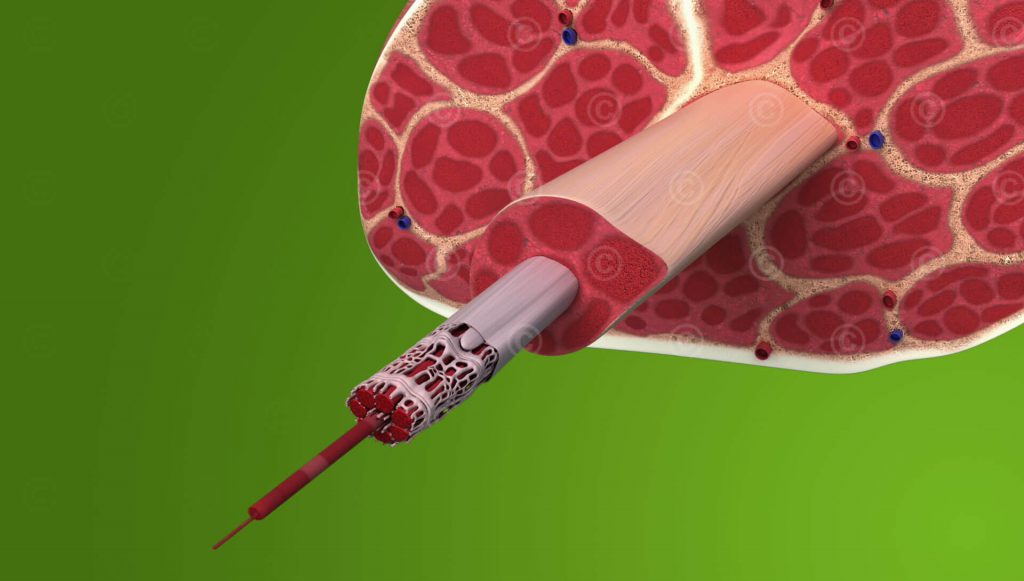 3D Animation Muskeln und Cytoskelett - MedicalGraphics