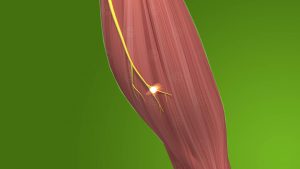 3D Animation Muskeln und Cytoskelett - MedicalGraphics