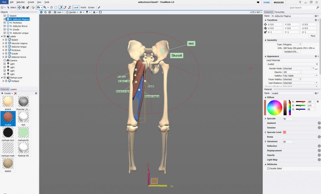 3D PDF and WebGL - MedicalGraphics