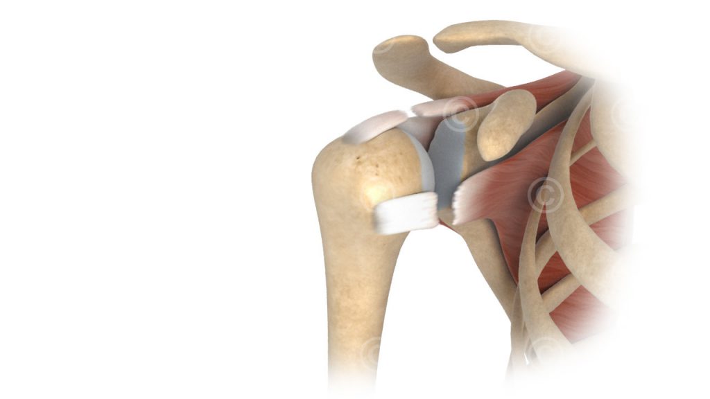 Illustrations injury shoulder - MedicalGraphics