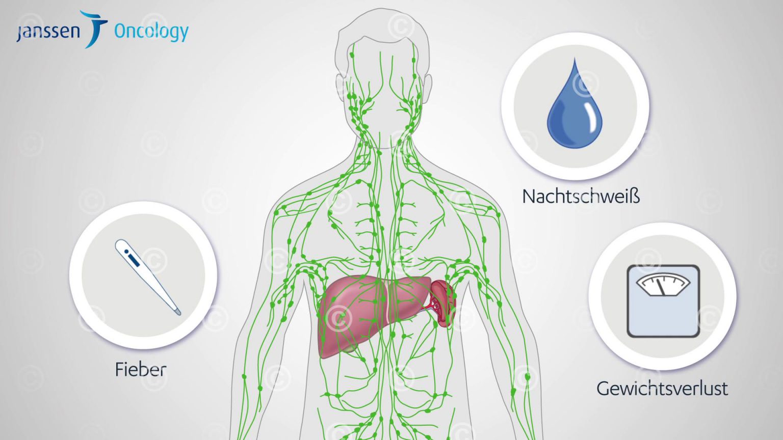 2D animation about chronic lymphocytic leukemia (CLL) - MedicalGraphics