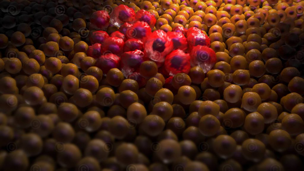 Animation growth of cancer cells - MedicalGraphics