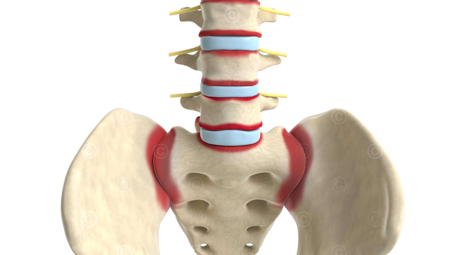 App enthesitis spine - MedicalGraphics