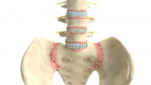 App enthesitis spine - MedicalGraphics