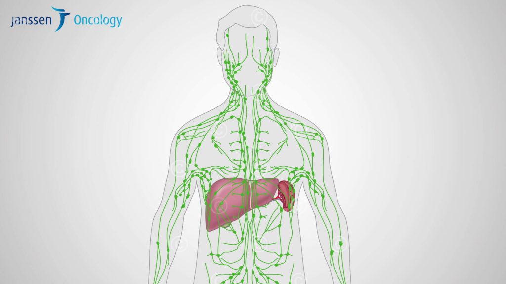 2D animation about chronic lymphocytic leukemia (CLL) - MedicalGraphics