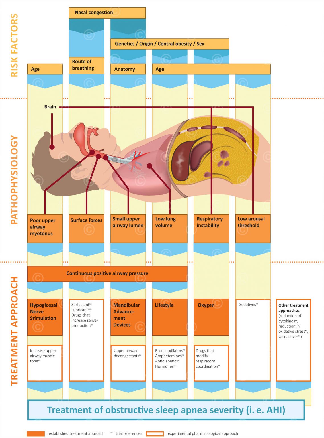 Grafic sleep apnea - MedicalGraphics
