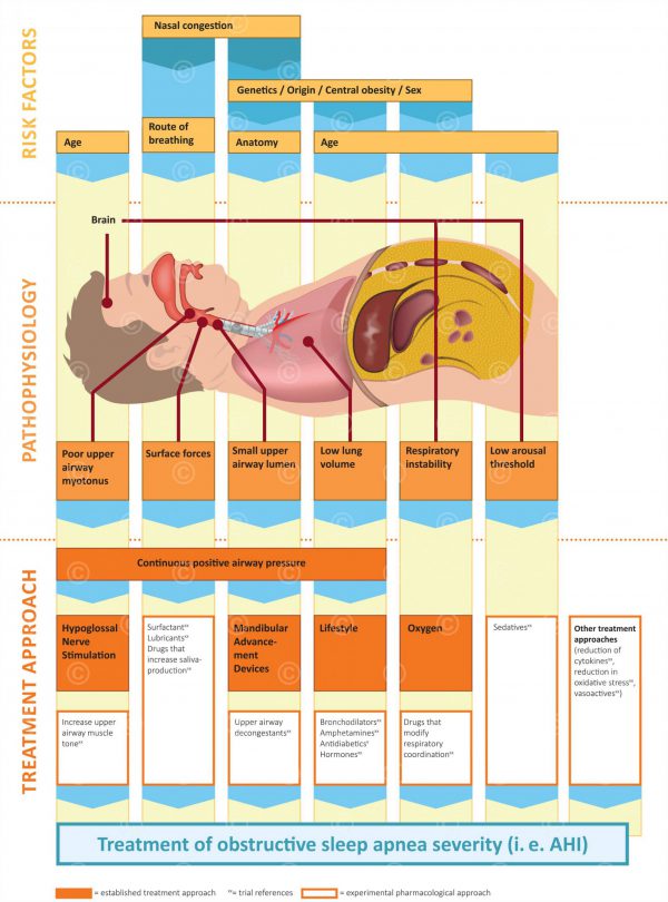 Grafic sleep apnea - MedicalGraphics