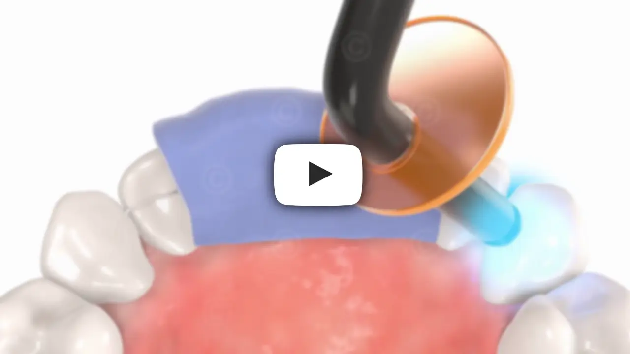 Dental Treatment Animation