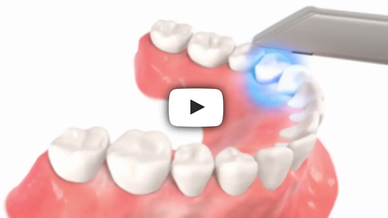 Dental Treatment Animation