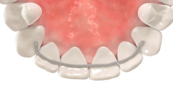 Animations Orthodontics - MedicalGraphics