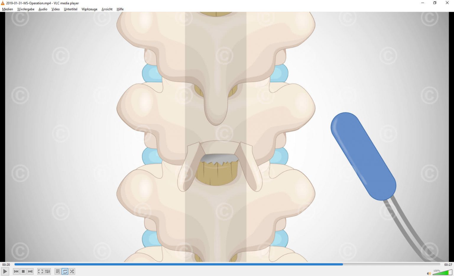 3D Animation Bewegungsapparat - MedicalGraphics