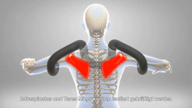 Treatment muscular imbalance shoulder - MedicalGraphics