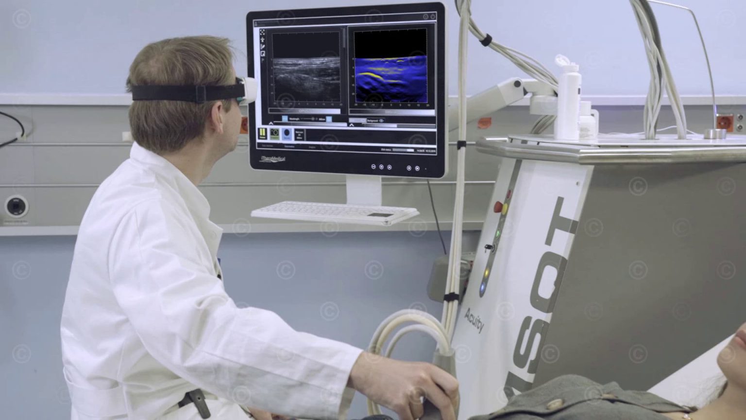 Animation monitoring inflammatory bowel diseases - MedicalGraphics