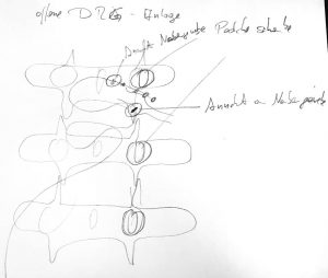 Illustrations DRG stimulation - MedicalGraphics