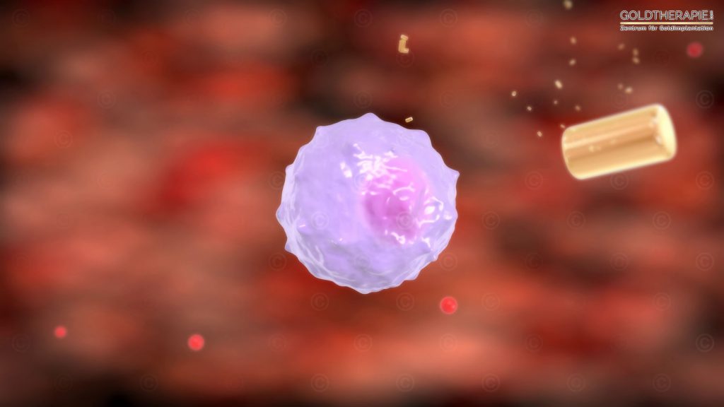 3D animation gold implantation - MedicalGraphics