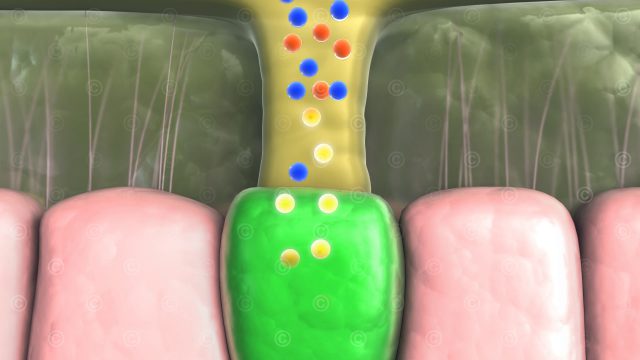 Animation nasal spray rhinitis - MedicalGraphics