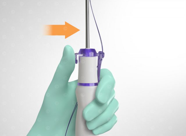 Illustrations surgical manual for pelvic floor prolapse - MedicalGraphics