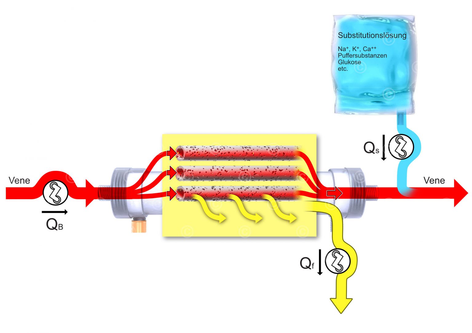 Illustrations publication dialysis - MedicalGraphics