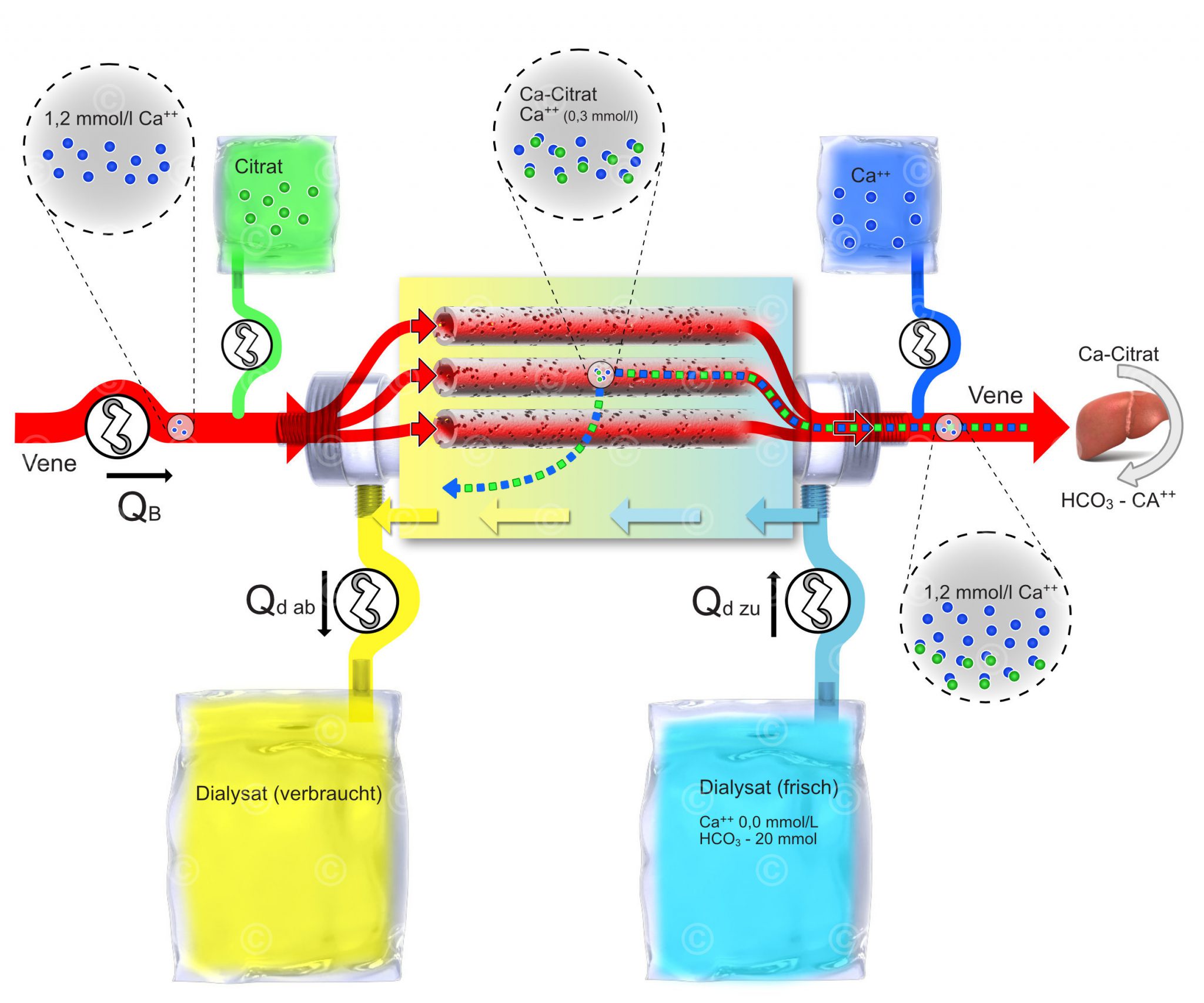 Illustrationen Publikation Dialyse - MedicalGraphics