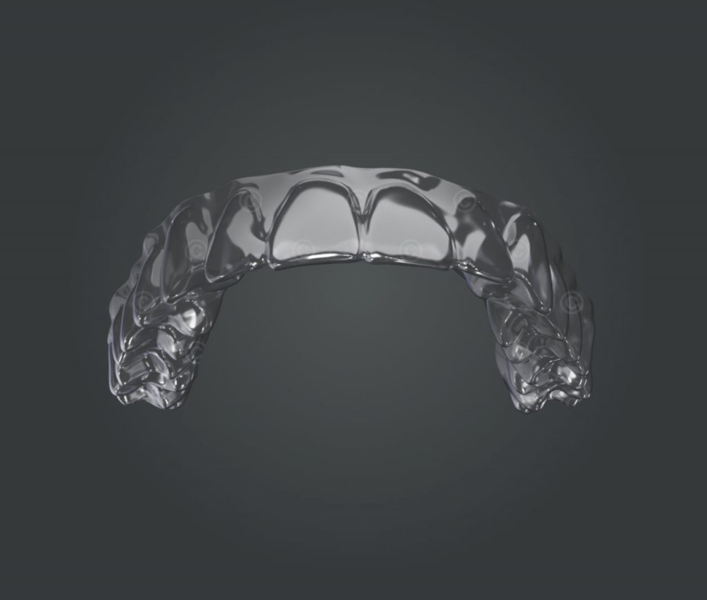 Aligner illustrations - MedicalGraphics