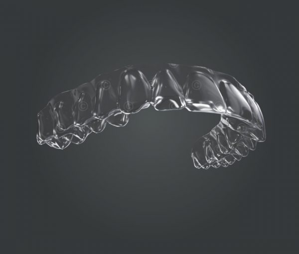 Aligner illustrations - MedicalGraphics
