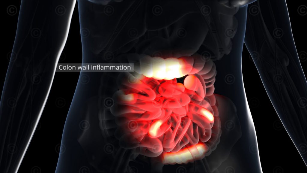 Optoacoustic imaging - 3D animation - MedicalGraphics
