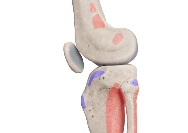 Illustrationen Muskelansätze Knie - MedicalGraphics
