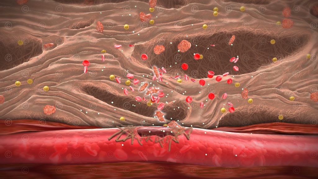 Animation skin replacement fish skin - MedicalGraphics