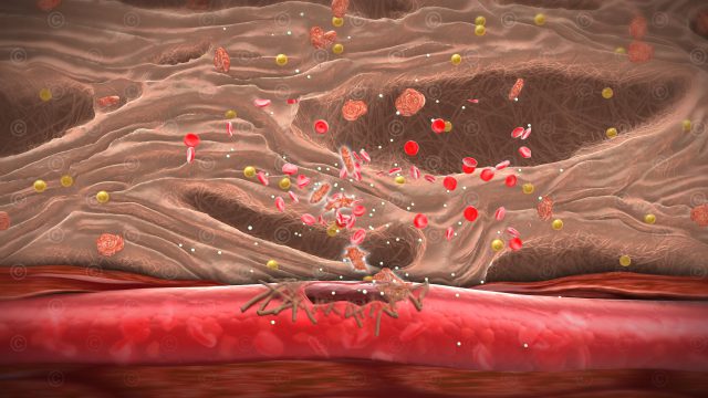 Animation skin replacement fish skin - MedicalGraphics