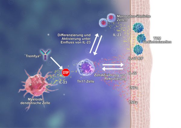 MOA illustration Tremfya - MedicalGraphics