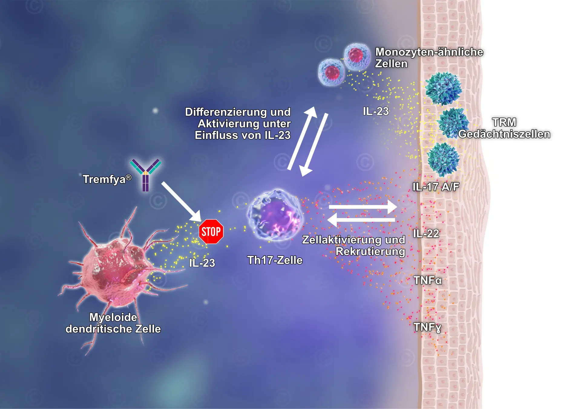 MOA illustration Tremfya - MedicalGraphics