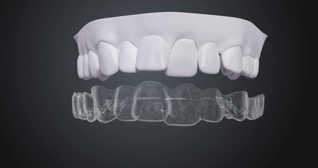 Animations Aligner therapy - MedicalGraphics